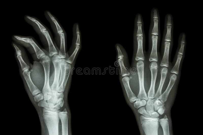 De Normale Mensen Overhandigen Stock Afbeelding - Image of achtergrond ...