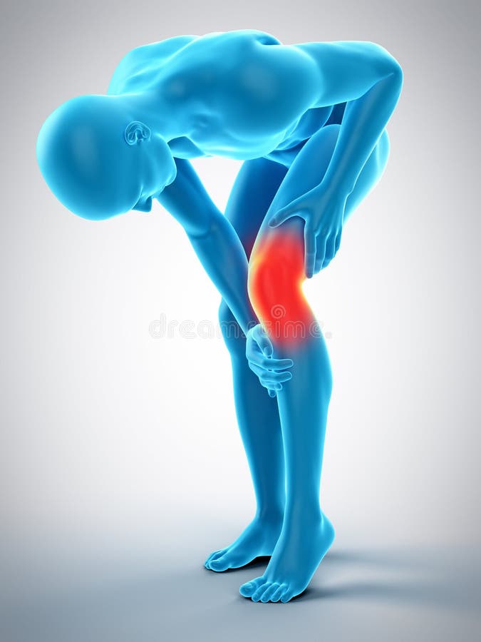 Kniepijn stock illustratie. Illustration of knieschijf - 74188856