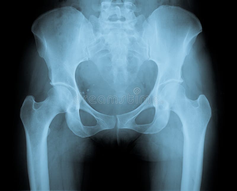 Bekken Stockfoto's en afbeeldingen - Download 10,727 foto's