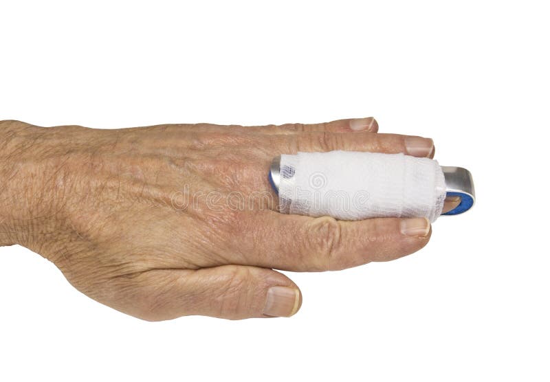 De splinter van de vinger stock afbeelding. Image of verwonding - 23611601