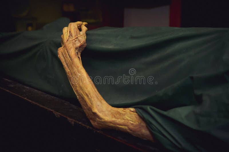The Dead Body. Focus on Hand Decay Stock Photo - Image of people ...