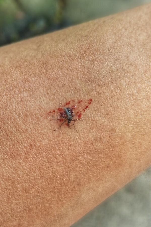 Dead mosquito on the skin stock photo. Image of brown - 264822738