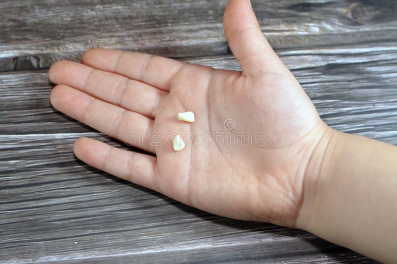 Deciduous Primary Baby Temporary Teeth, the First Set of Teeth in the ...