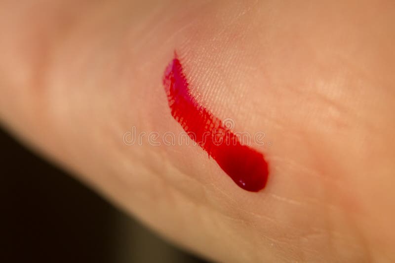 Injured by a Knife stock image. Image of hospital, murder - 69409943