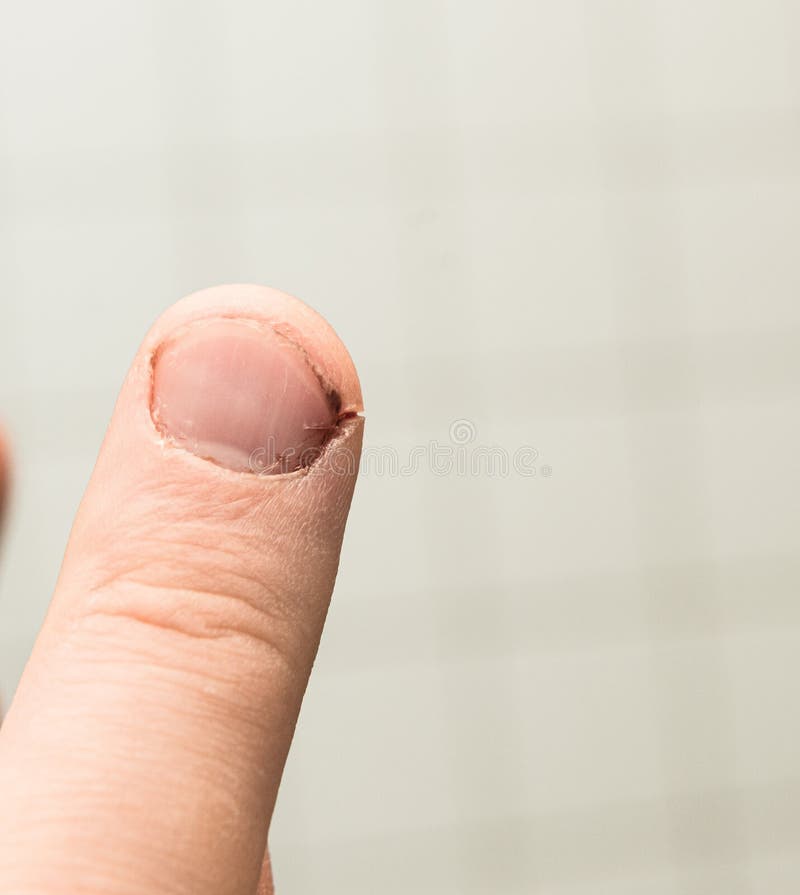 Deep cut in a finger tip.. stock photo. Image of business - 317454750