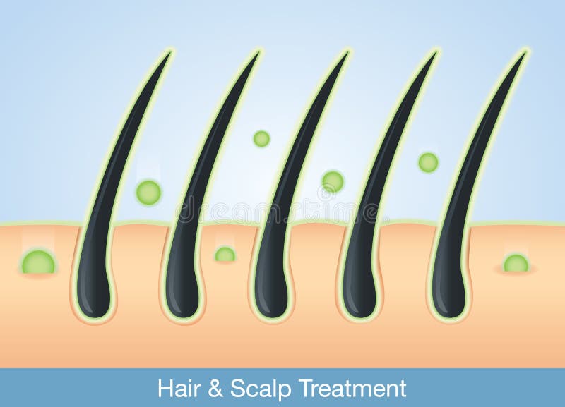Hair Scalp Stock Illustrations – 6,431 Hair Scalp Stock Illustrations ...