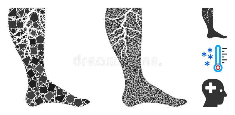 Deep Vein Thrombosis Icon Stock Illustrations – 133 Deep Vein ...