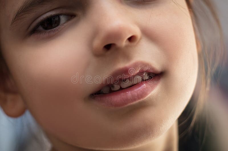 Defective Teeth Can Create Various Problems Stock Photo - Image of ...