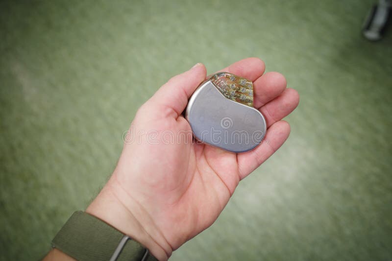 A Defibrillator is in the Hand Stock Image - Image of medical, hospital ...