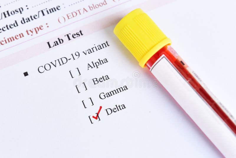 Delta Variant COVID-19 Positive Result Stock Photo - Image of alpha ...