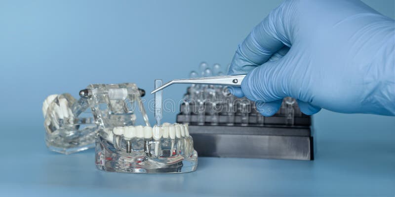 Demonstration of a Dental Implant with a Size Scale Stock Image - Image ...