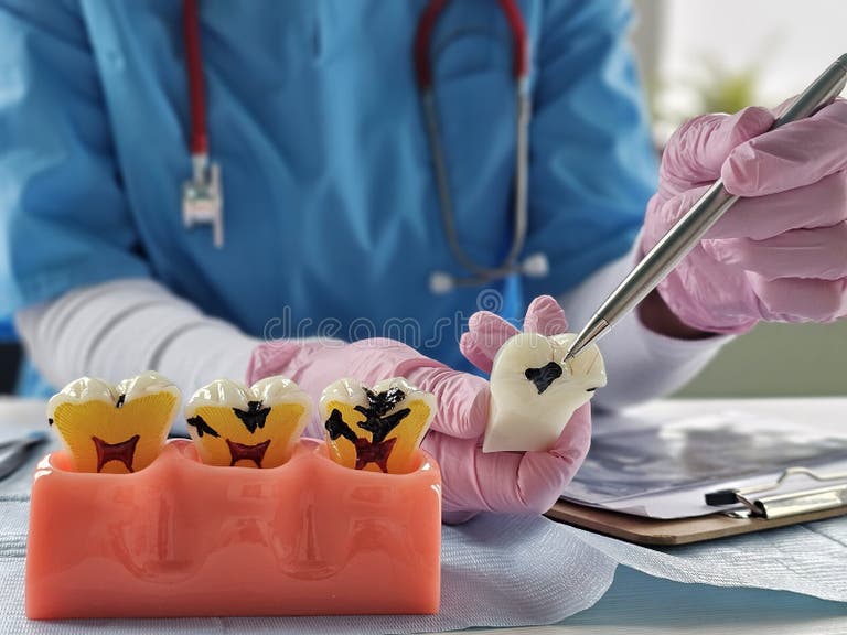 Demonstration of Dental Restoration Techniques in a Clinical Setting ...