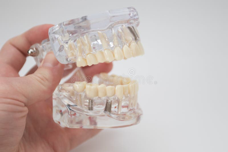 Demonstration Model of a Human Jaw Stock Image - Image of tool ...