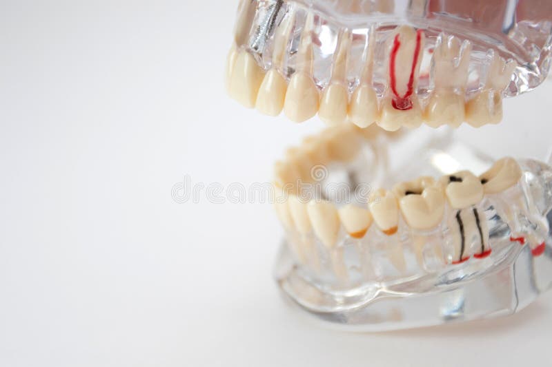 Demonstration Plastic Jaw with Teeth on a White Background Stock Photo ...