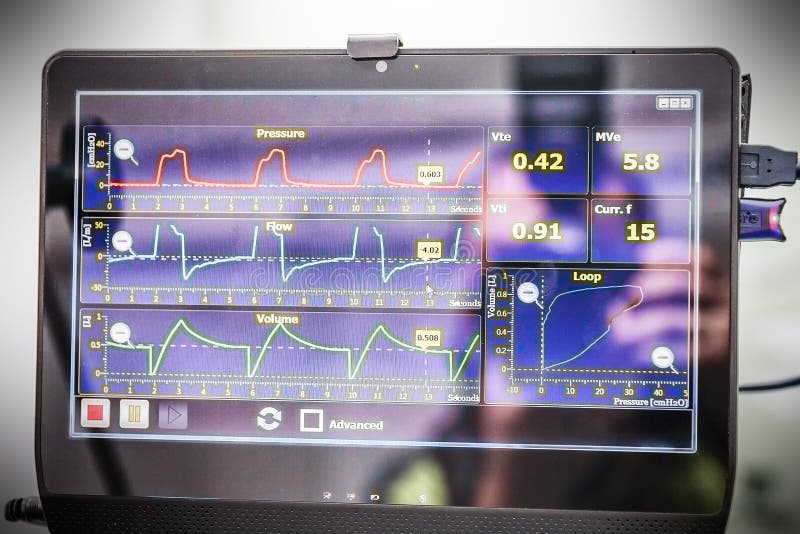 Mechanical Ventilation Equipment Stock Photo - Image of artificial ...