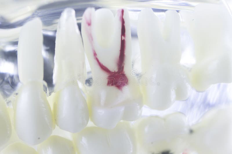 Den Tand- Tanden Rotar Kanalen Arkivfoto - Bild av bakgrund, utrustning ...