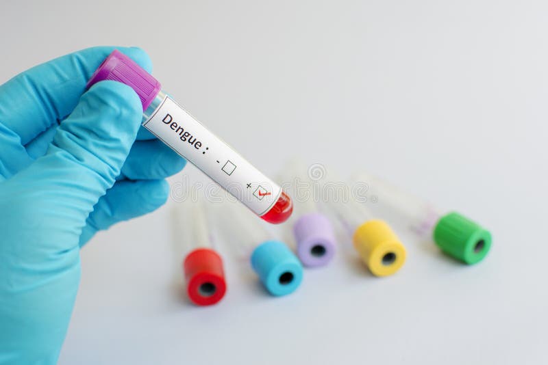 Dengue blood sample stock photo. Image of patient, scientific - 60862106
