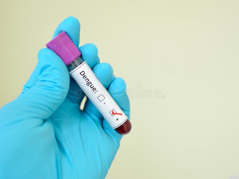 Dengue positive stock photo. Image of illness, virology - 55278150