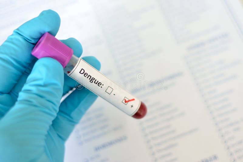 Dengue positive stock image. Image of virology, hospital - 55278349