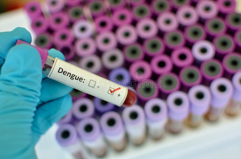Dengue positive blood tube stock photo. Image of mosquito - 109343156