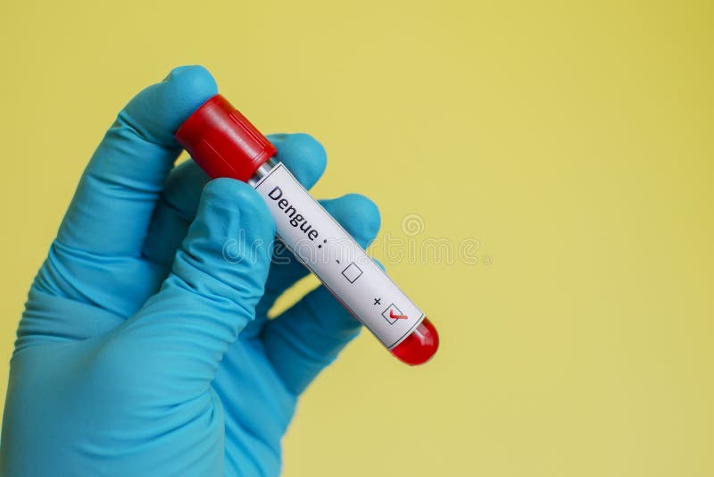 Dengue positive stock image. Image of exam, laboratory - 59057825