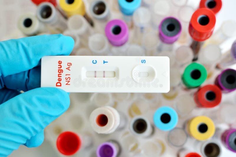 Dengue positive stock photo. Image of virus, medicine - 80025868