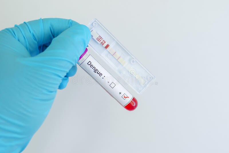 Dengue testing positive stock photo. Image of culex, dengue - 60859362