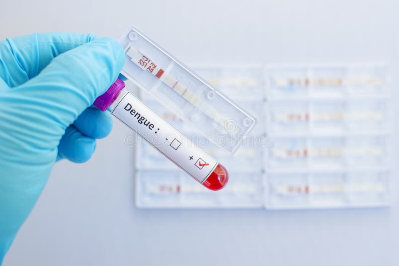 Dengue testing positive stock photo. Image of biology - 60861542