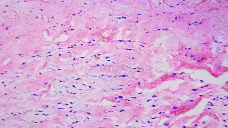 Longitudinal Section of Human Tongue Showing Filiform Papillae Under ...