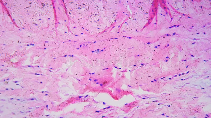 Dense Connective Tissue in Longitudinal Section Under Microscope 200x ...