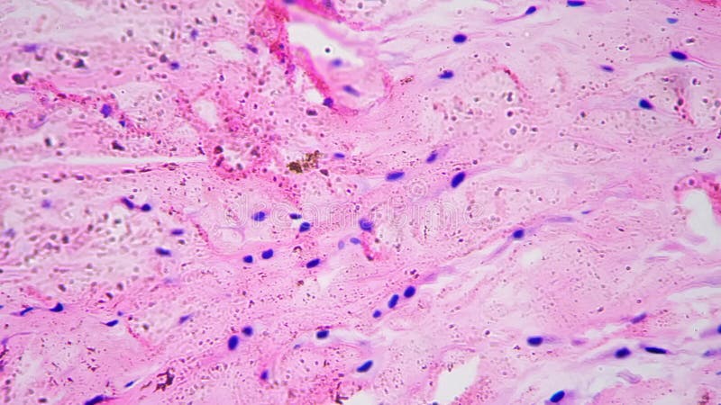 Dense Connective Tissue in Longitudinal Section Filmed by Microscope ...