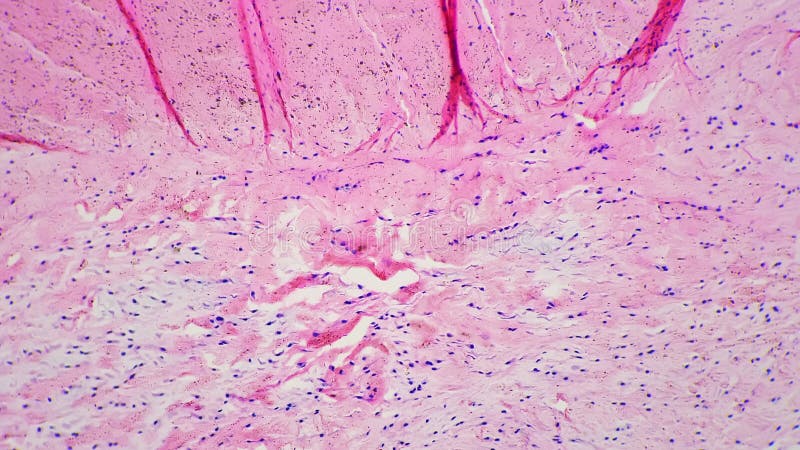 Dense Connective Tissue in Longitudinal Section Under Microscope 400x ...