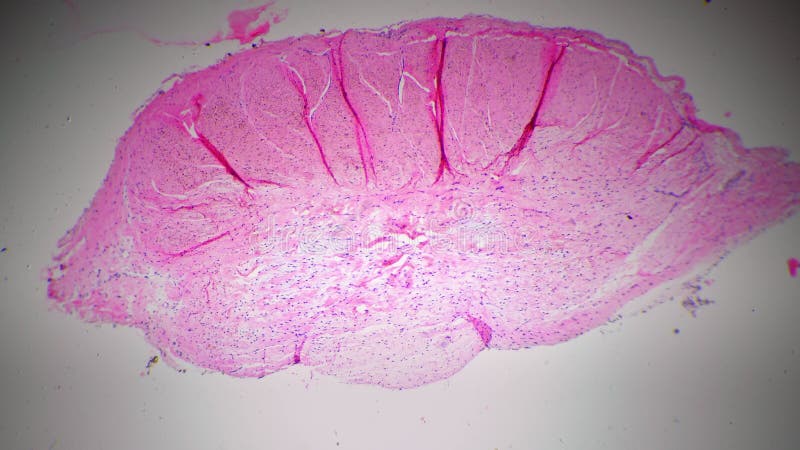 Dense Connective Tissue in Longitudinal Section Filmed by Microscope ...