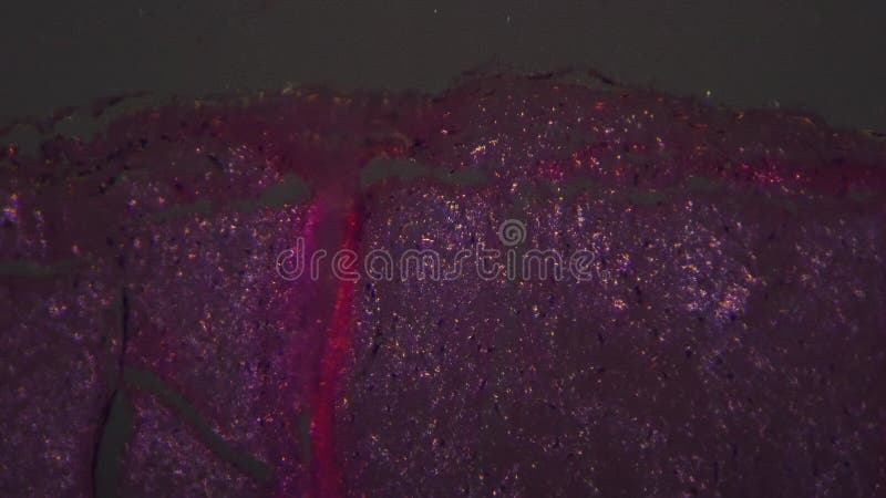 Dense Connective Tissue in Longitudinal Section Filmed by Microscope ...