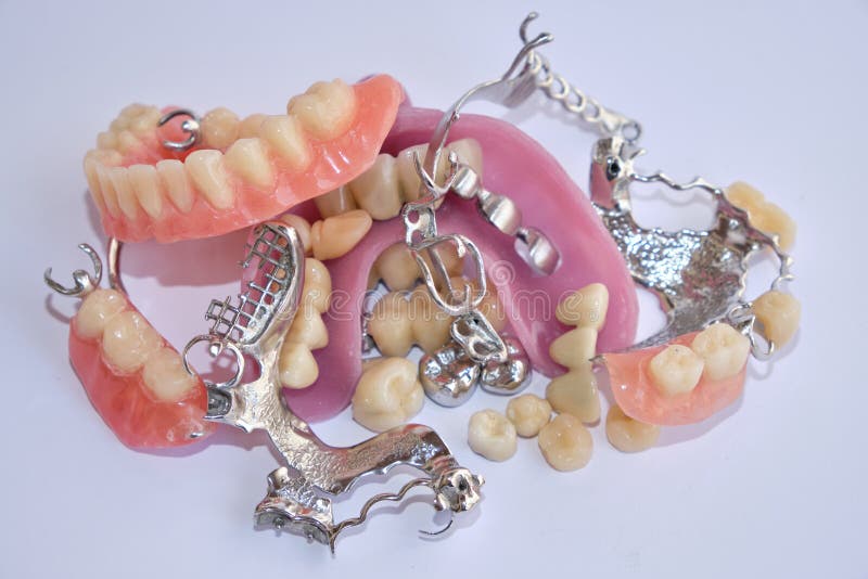 Dental Appliances and Dental Prostheses. Stock Photo - Image of ...