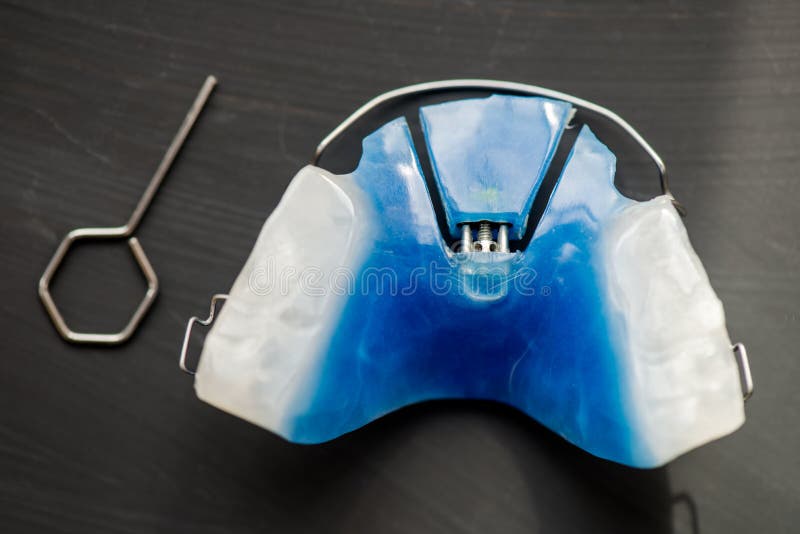 Dental Blue Removable Braces or Retainers for Teeth Stock Image - Image ...