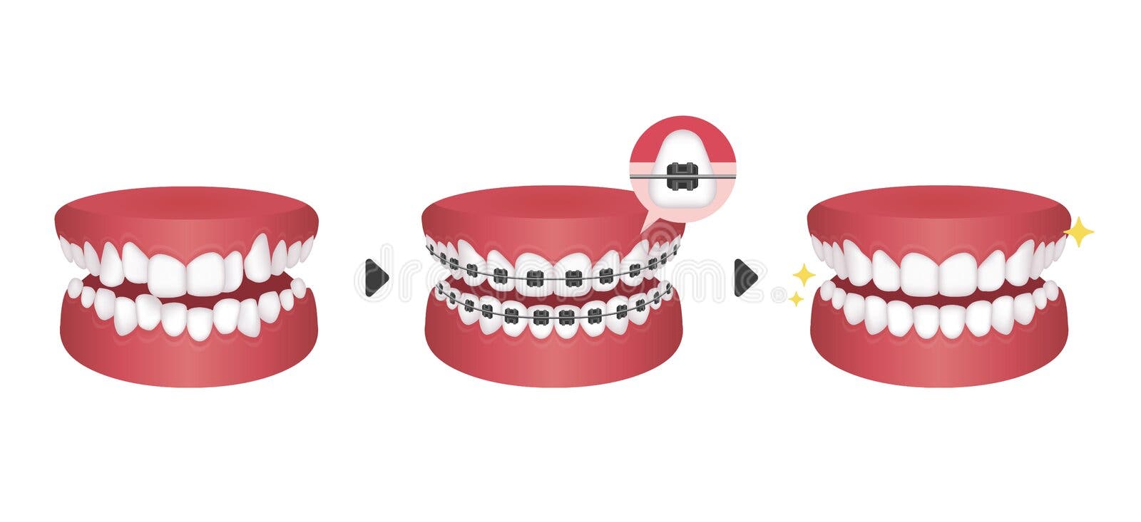Alignment Process Stock Illustrations – 430 Alignment Process Stock ...