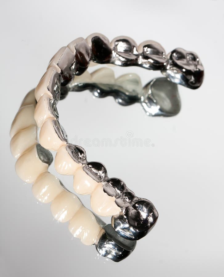 Dental bridge stock photo. Image of reflection, hygiene - 30240456