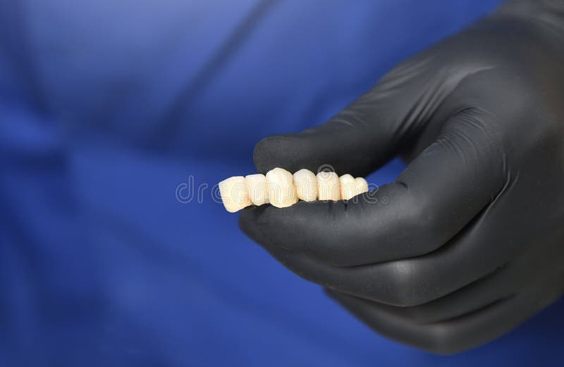 Dental Bridge in the Hands of a Dentist Stock Image - Image of denture ...