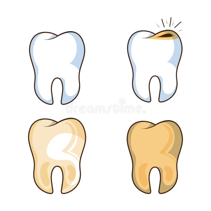 Dental Stained Teeth Stock Illustrations – 126 Dental Stained Teeth ...