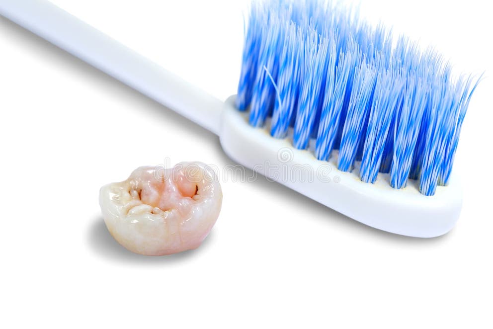 Dental Caries and Tooth Brush. Stock Photo - Image of prophylactic ...