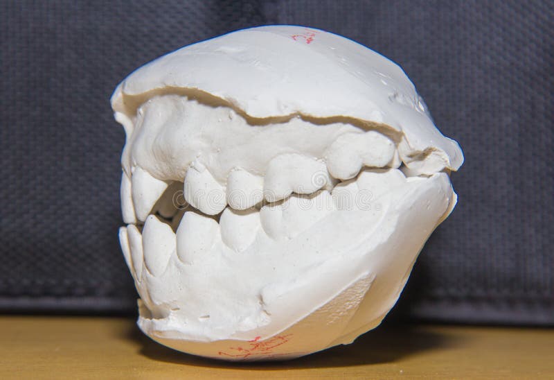 Dental cast stock image. Image of healthy, tooth, important - 29665475