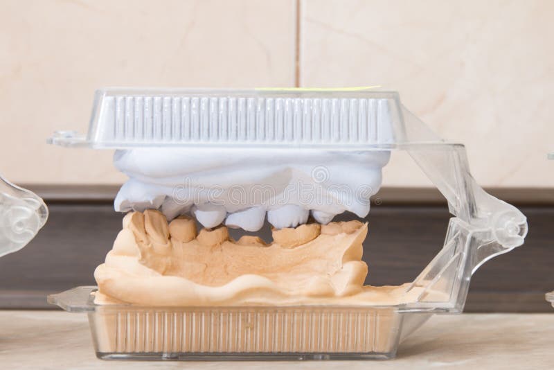 Dental Casting Gypsum Models Plaster Stock Photo - Image of crown ...