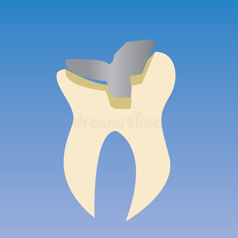 Dental Crown and Tooth. Vector Illustration Decorative Design Stock ...