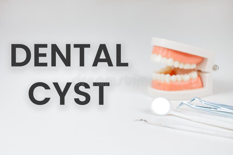 "Dental Cyst" Title Denoting the Name of a Dental Disease Stock Photo ...