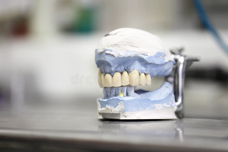 Dental dentist objects stock image. Image of healthcare - 37800079