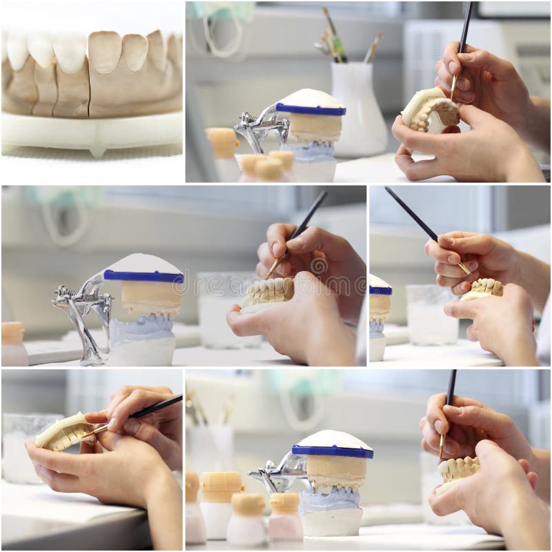 Dental Dentist Objects Collage Stock Photo - Image of artificial ...