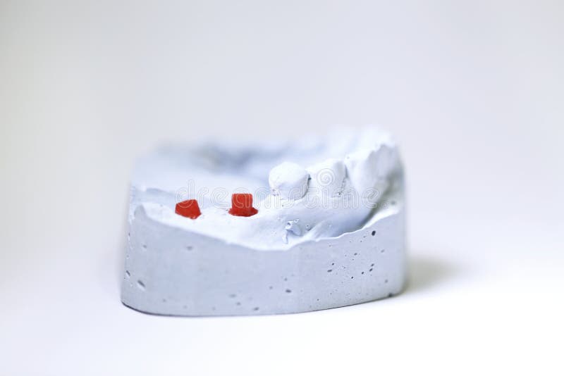 Dental dentist objects stock photo. Image of dental, dentist - 37507644