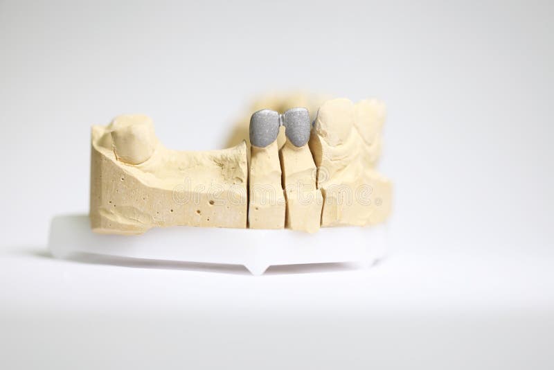 Dental dentist objects stock image. Image of healthcare - 37507651