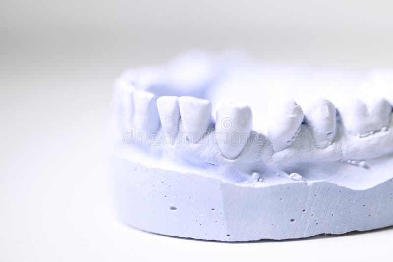 Dental dentist objects stock photo. Image of ceramic - 37507756